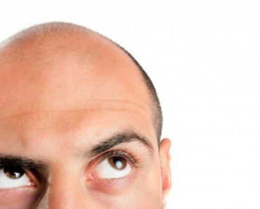 Worst Hairstyles For Balding Men Archives - Kaiser Magazine